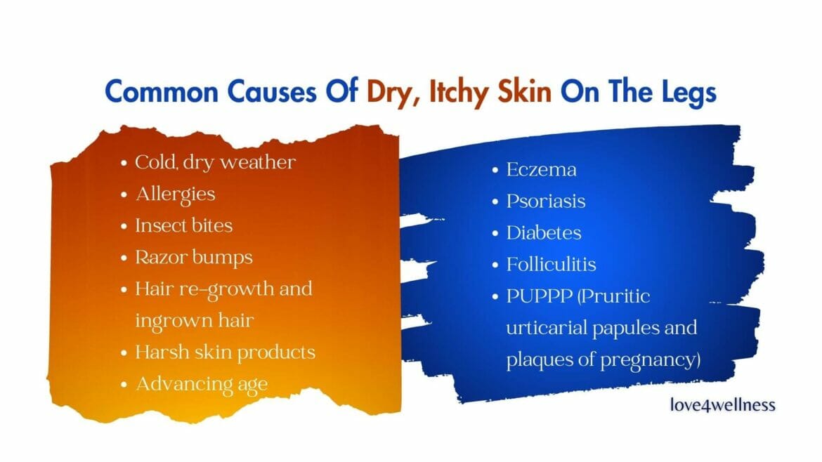 Dry, Itchy Skin On The Legs? Useful Remedies & 6 Tips To Prevent